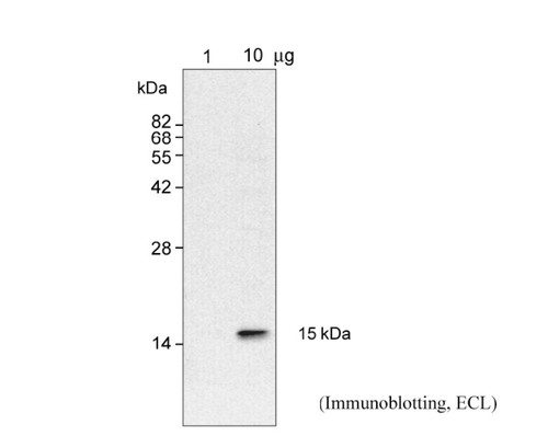 Anti S14, Ribosomal Protein (Ribosome) pAb Antibody [Catalog No.: COP ...