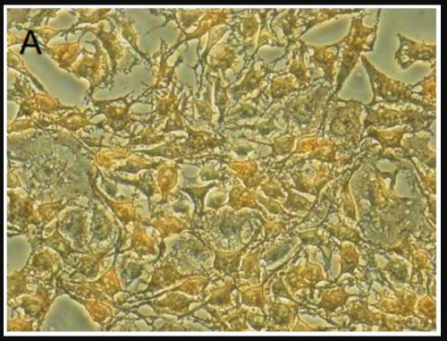 GIST-T1 Cell Line [Catalog No.: PMC-GIST01C-COS]