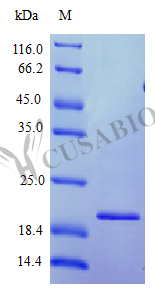 Recombinant Human Interferon omega-1 protein(IFNW1) (Active) (CSB ...