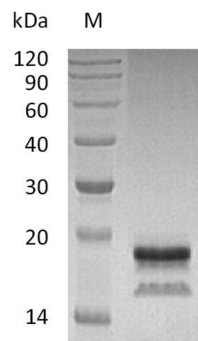 Recombinant Human Interleukin-17A(IL17A) (Active) (CSB-AP004341HU)