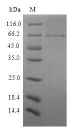 Recombinant Sindbis virus Structural polyprotein,partial (CSB ...