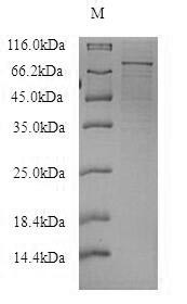 Recombinant Human RNA exonuclease 4(REXO4) (CSB-CF863931HUa6)
