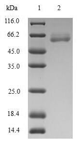 Recombinant Human Arginase-2, mitochondrial(ARG2) (CSB-EP002006HU)