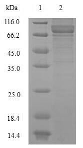 Recombinant Human Neurofilament light polypeptide(NEFL) (CSB-EP015688HU)