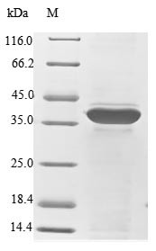 Recombinant Human 40S ribosomal protein SA(RPSA) (CSB-EP020485HUb1)
