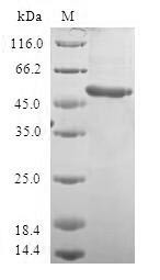 Recombinant Human Homeobox protein VENTX(VENTX) (CSB-EP528513HU)