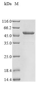 Recombinant Human Gasdermin-B(GSDMB) (CSB-EP823445HU)