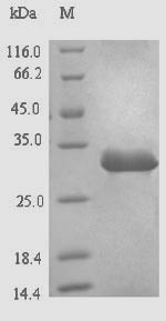 Recombinant Hepatitis B virus genotype D subtype ayw Protein X(X) (CSB ...