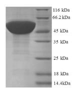 Recombinant Human 60S ribosomal protein L17(RPL17) (CSB-RP025044h)