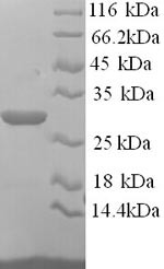 Recombinant Mouse Asialoglycoprotein receptor 1(Asgr1),partial (CSB ...