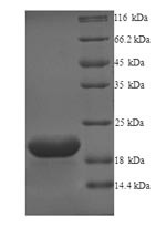 Recombinant Human Probable G-protein coupled receptor 75(GPR75),partial ...