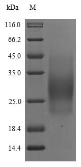 Recombinant Human Interleukin-5(IL5) (CSB-YP011662HU)