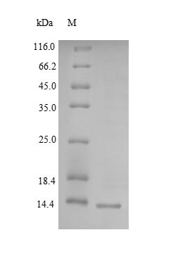 Recombinant Human Lymphocyte antigen 6H(LY6H) (CSB-YP013249HU)