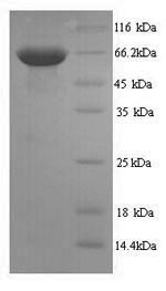 Recombinant Human Receptor-type tyrosine-protein phosphatase C(PTPRC ...