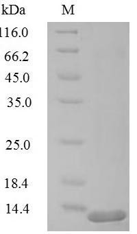 Recombinant Human Replication factor C subunit 1(RFC1),partial (CSB ...