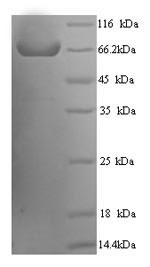 Recombinant Human Receptor-type tyrosine-protein phosphatase N2(PTPRN2 ...