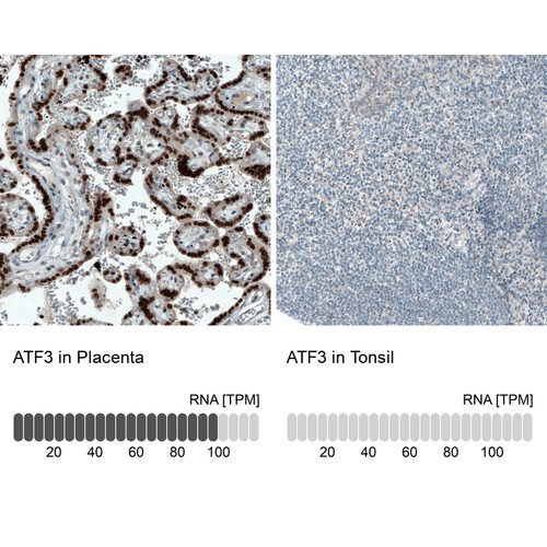 Anti ATF3 mAb [Catalog No.: ATL-AMAb90909]