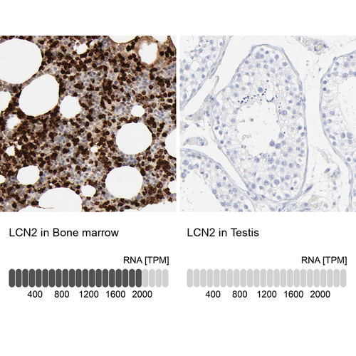 Anti LCN2 pAb [Catalog No.: ATL-HPA002695]