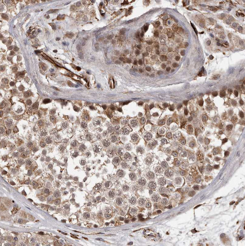 Anti BRAT1 pAb [Catalog No.: ATL-HPA029455]