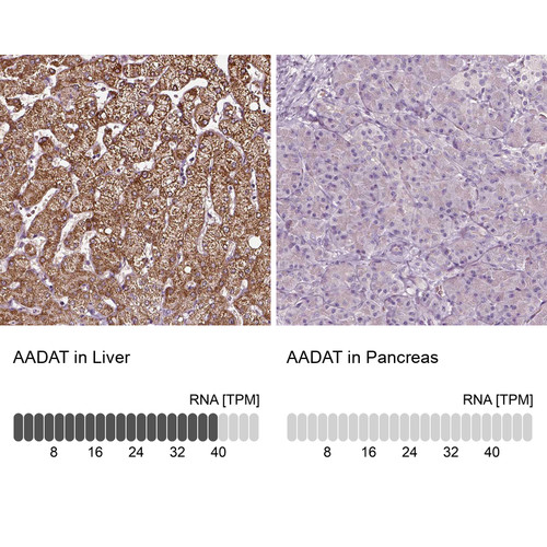 Anti AADAT pAb [Catalog No.: ATL-HPA037502]