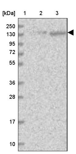 Anti U2SURP pAb [Catalog No.: ATL-HPA037545]