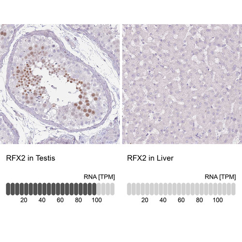 Anti RFX2 pAb [Catalog No.: ATL-HPA048969]