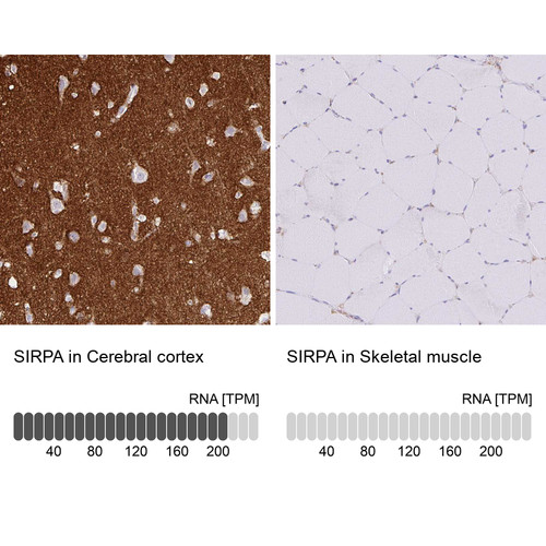 Anti SIRPA pAb [Catalog No.: ATL-HPA054437]
