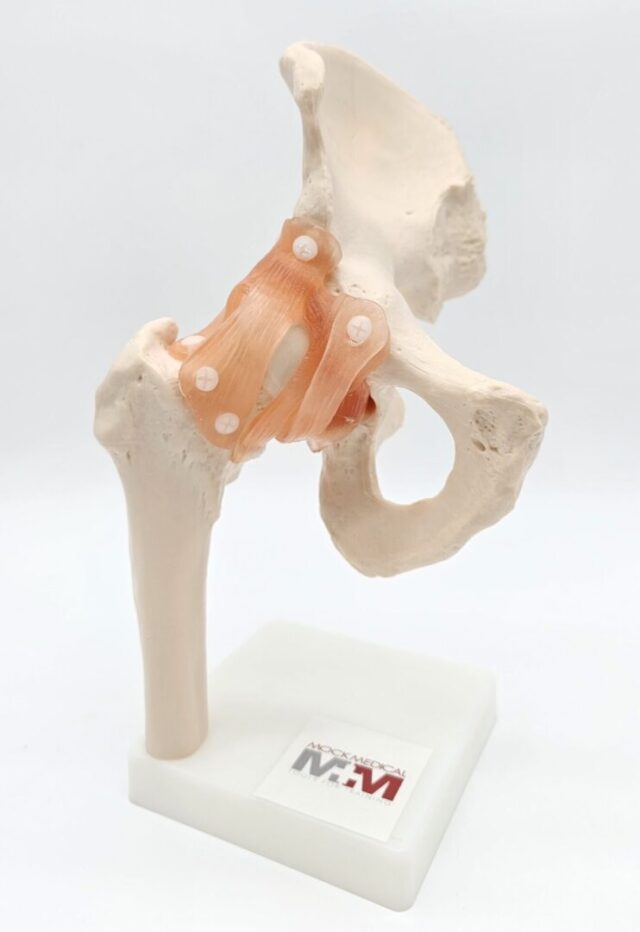 Hip Joint Model - Mock Medical