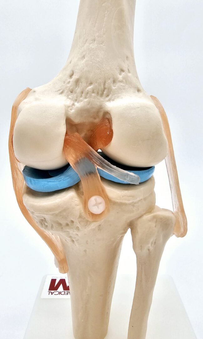Knee Joint Model - Mock Medical