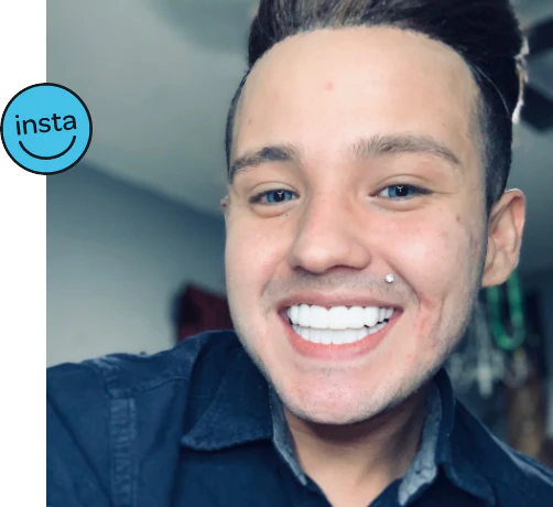 Cosmetic Enhancement | Cosmetic Enhancing Veneers – us.instasmile.com