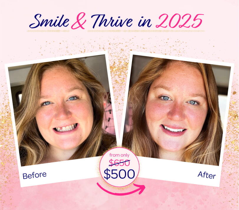 Clip On Veneers | Revolutionary Veneers | instasmile – au.instasmile.com