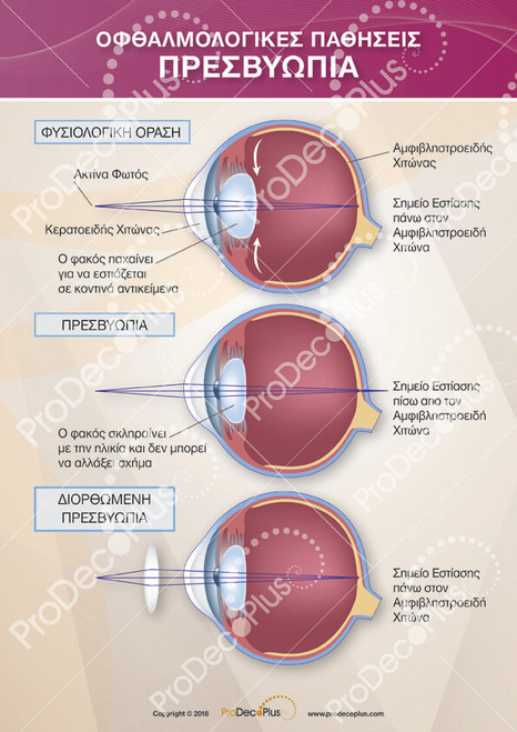 Eye & Eye Diseases Package GREEK (7 pieces) - ProDecoPlus