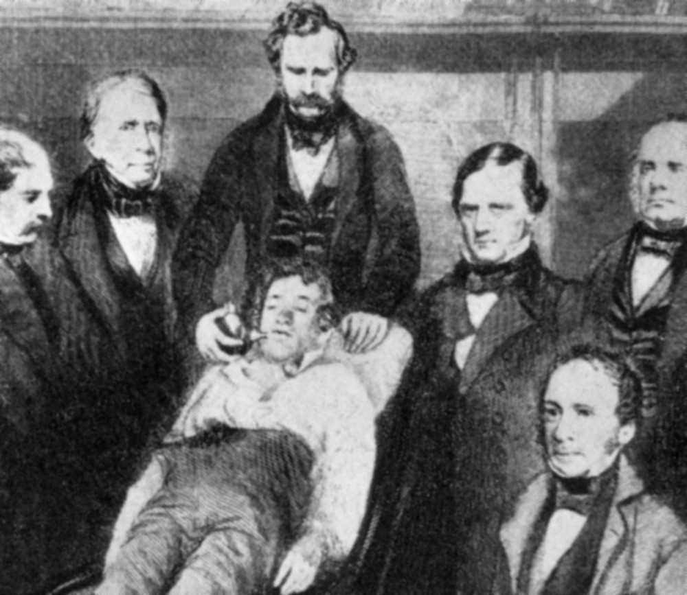 First Use of Surgical Anesthesia, 1846 Poster Print by Science Source ...