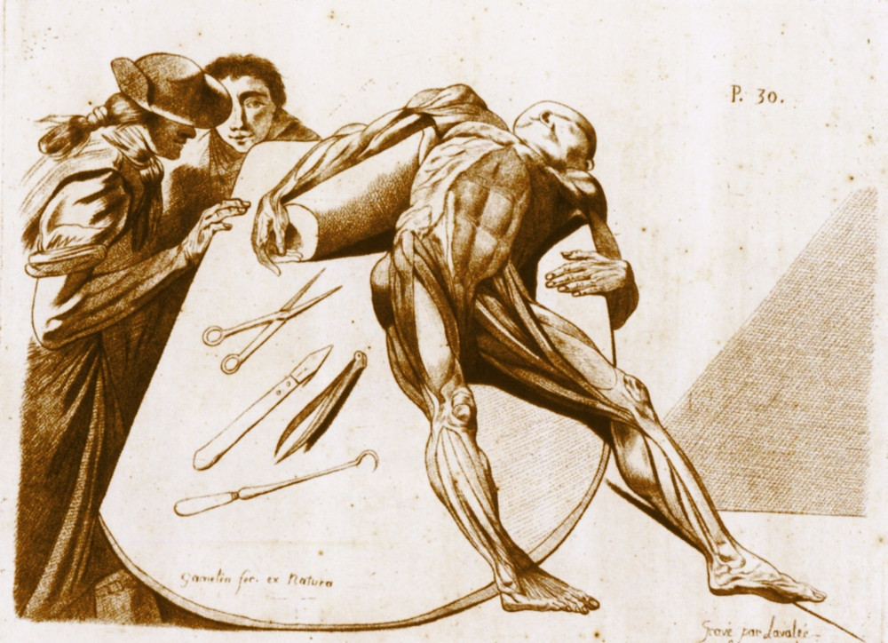 Contemplating a Cadaver Poster Print by Science Source - Item ...