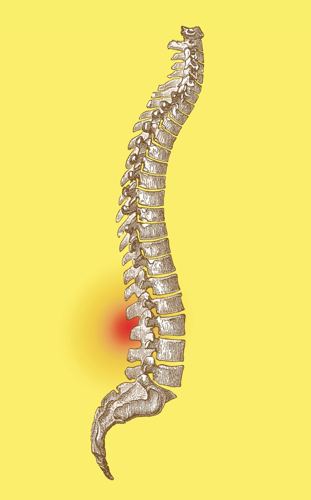 Lower Back Pain Poster Print by Science Source - Item # VARSCIBH4335 ...