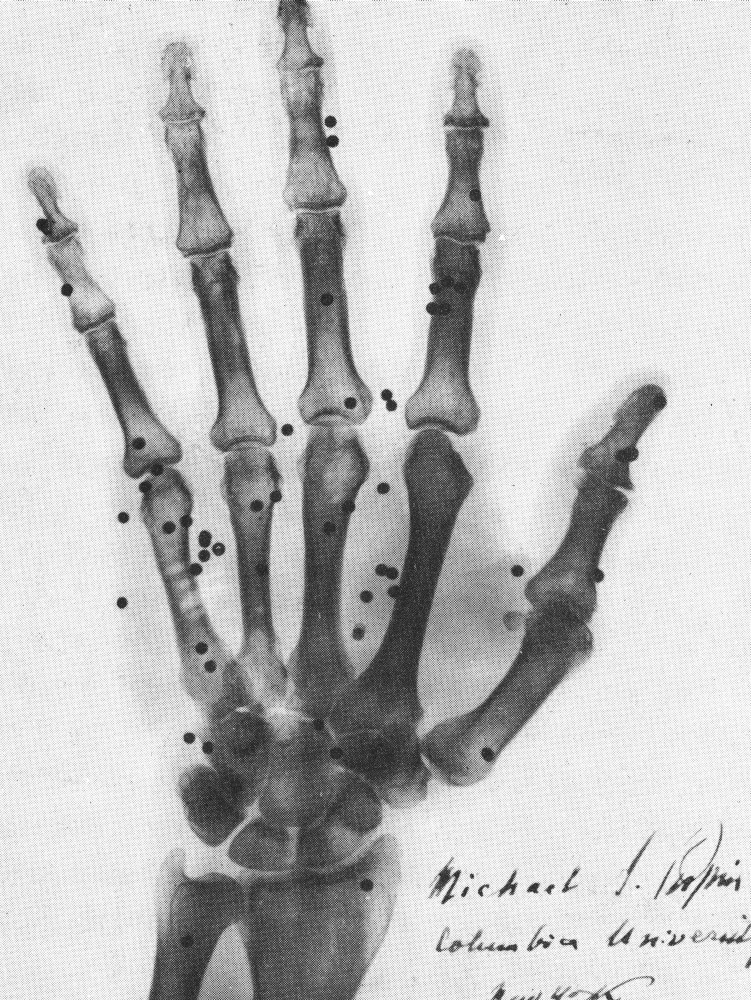 X-ray of a hand with buckshot Poster Print by Science Source - Item ...