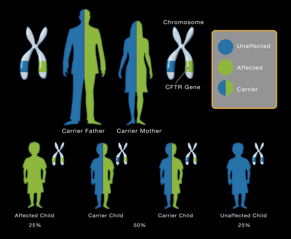 CFTR Mutation Inheritance Patterns Poster Print by Monica Schroeder ...