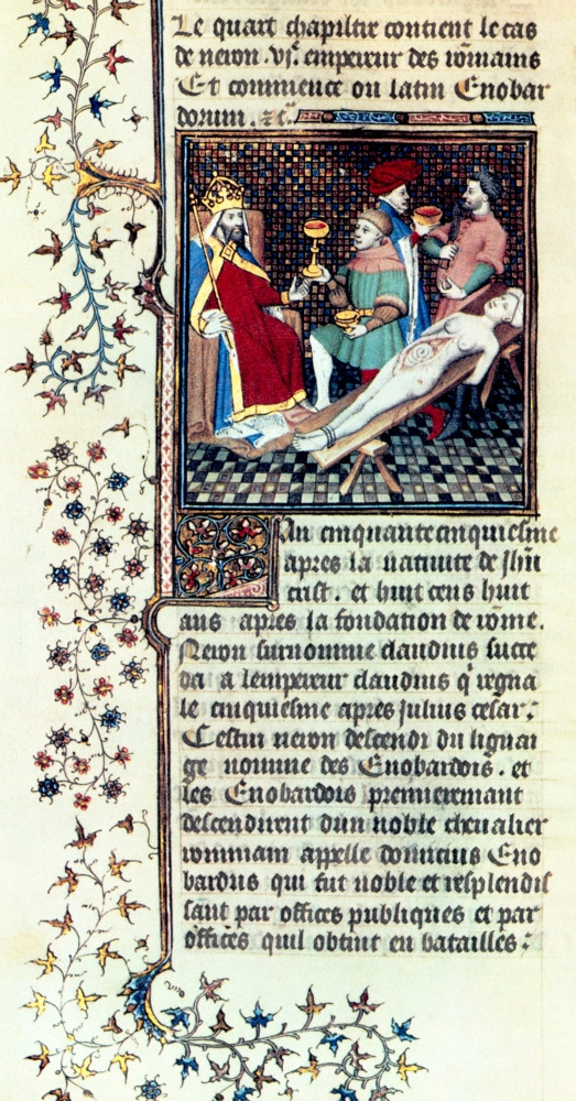 Medieval Autopsy Poster Print by Science Source - Item # VARSCIBM8773 ...
