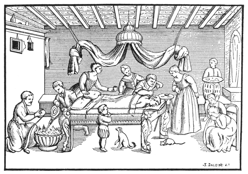 Trephining, 16Th Century. /Na Surgeon Trephining The Skull Of A Patient ...