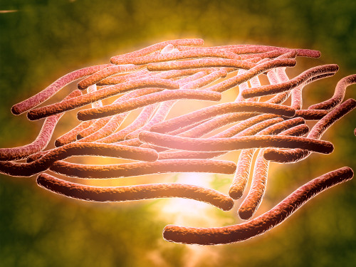 Microscopic view of Legionella pneumophila Poster Print - Item ...