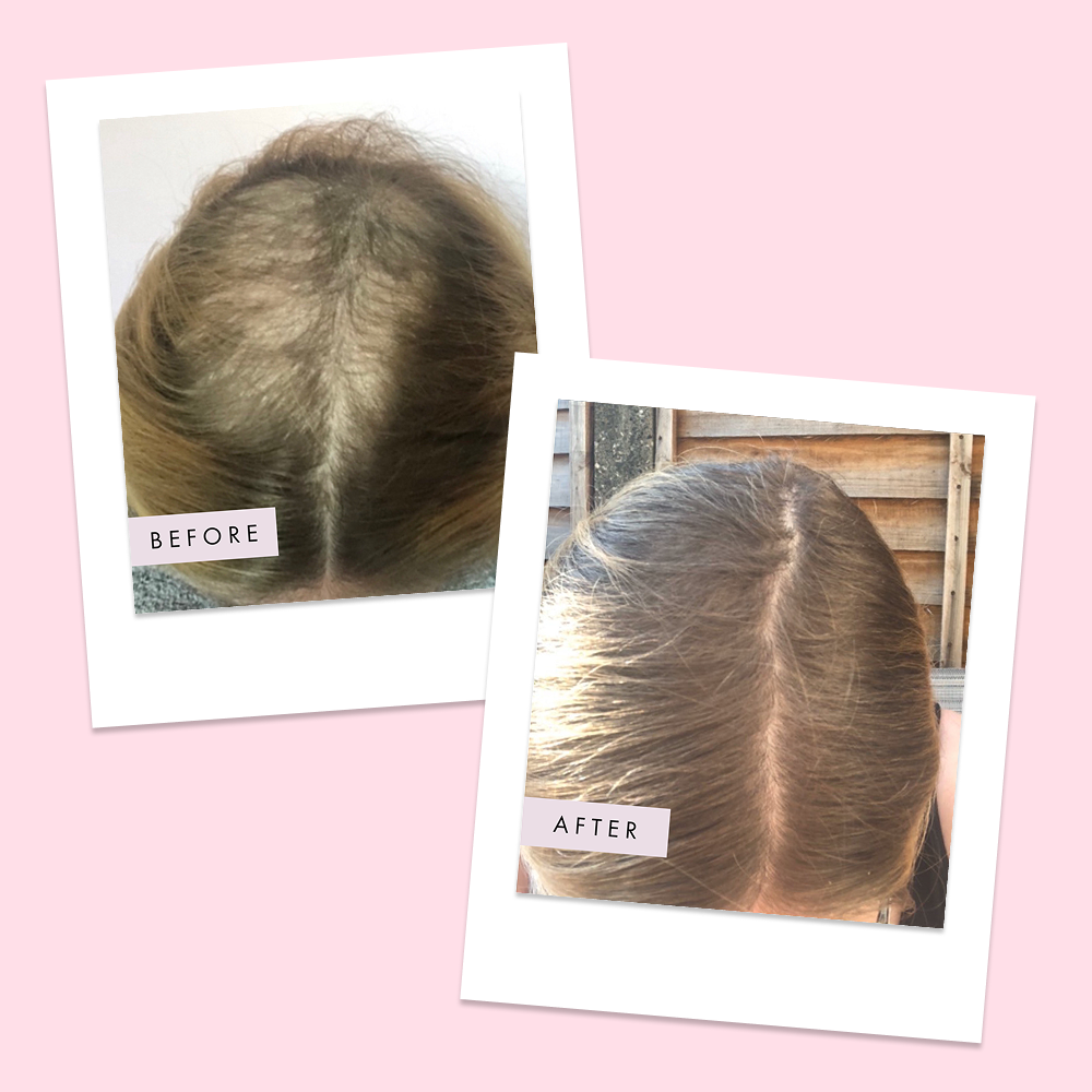Hair Gain Hair Capsules 60pcs