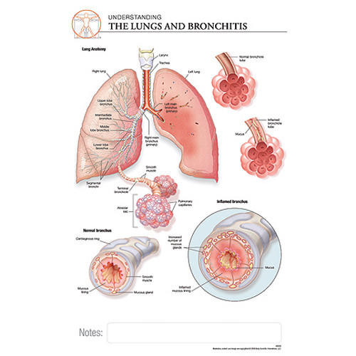Bronchitis "Post It" Chart (Pack of 10)