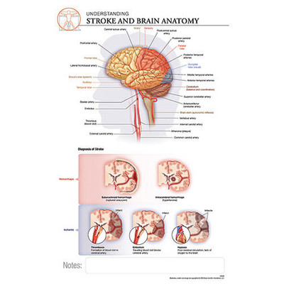 Stroke "Post It" Chart (Pack of 10) | Certified Material Testing Products