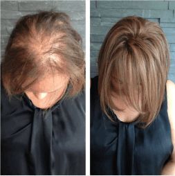 Real Hair Loss Help with Custom Hair Systems for Women - Cindycut