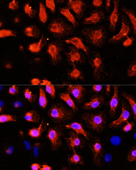 Anti-ACTN2 rabbit polyclonal antibody - WB, IHC-P, IF, ICC & ELISA