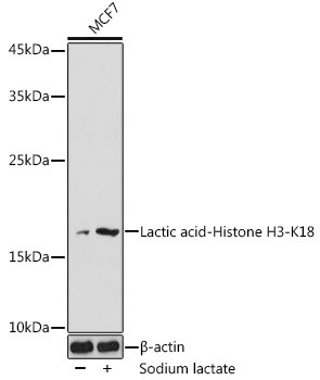 H3K18la antibody | Anti-H3K18la | stjohnslabs