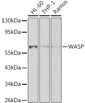 WAS antibody | Anti-WAS | stjohnslabs