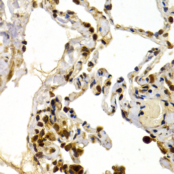 TFDP1 antibody | Anti-TFDP1 | stjohnslabs