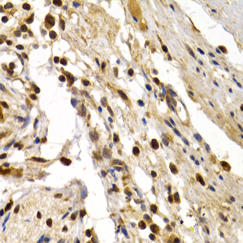 TFDP1 antibody | Anti-TFDP1 | stjohnslabs
