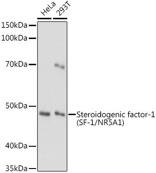 Anti-NR5A1 rabbit polyclonal antibody - WB & ELISA